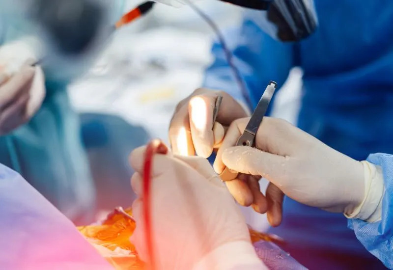 Neuromonitorização Operatória em Neurocirurgias | Neuro Exames